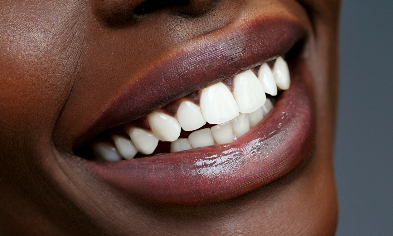 Crystal Bright, Tandenbleekbehandeling (60 of 120 min) bespaar 50% in ...